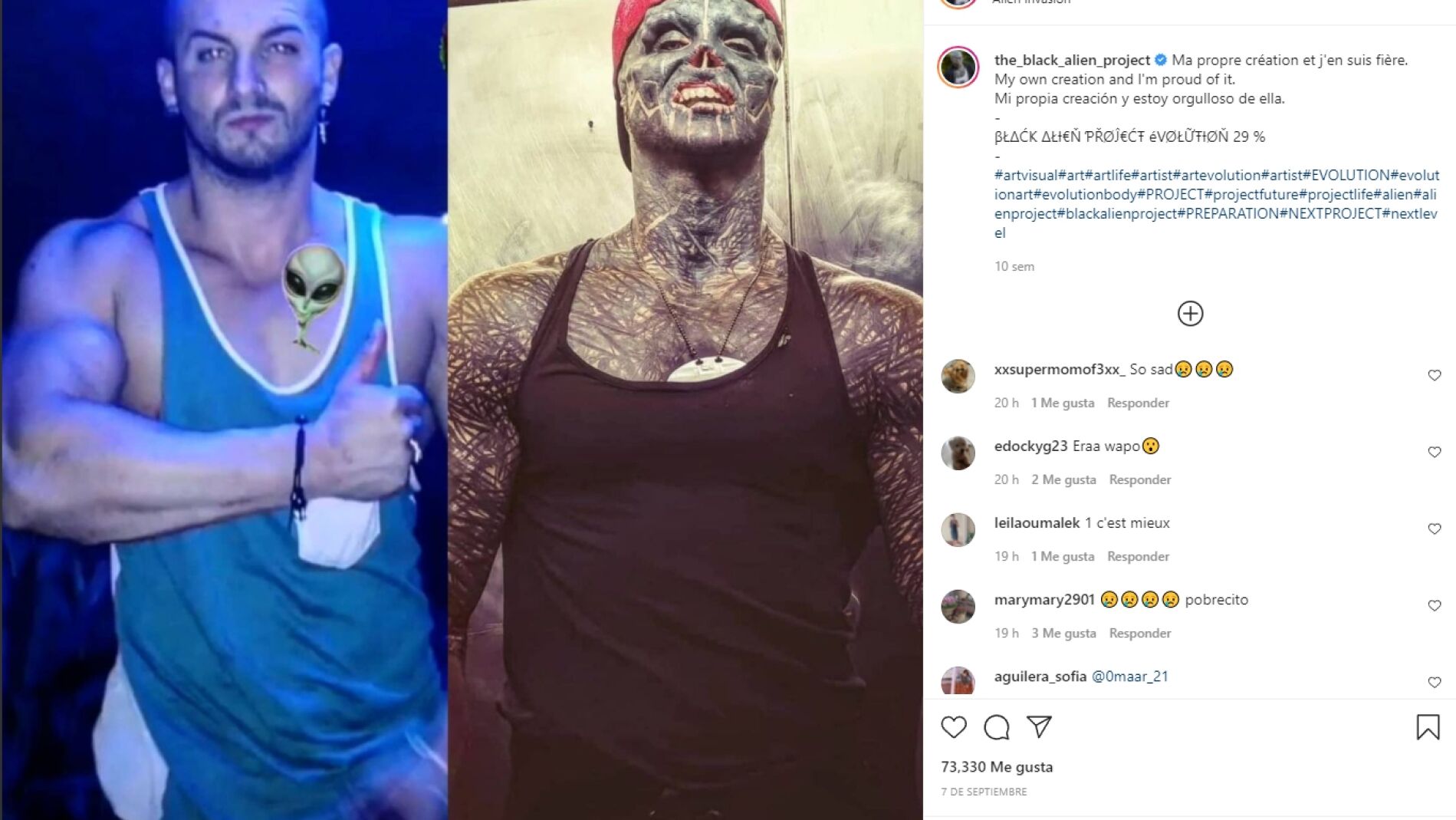 El joven que quiere convertirse en alien se corta dos dedos de cada mano