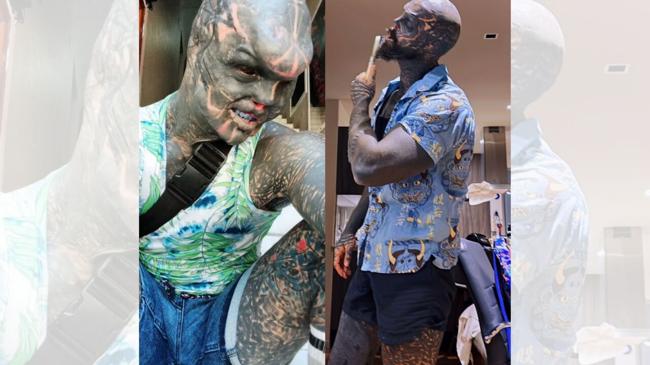 Black Alien quiere revertir su proceso y empezará reconstruyéndose el rostro